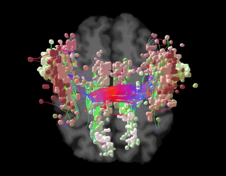 The Salience Network The Salience Network